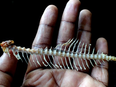 What to know about a fishbone in the throat - Graphic Online