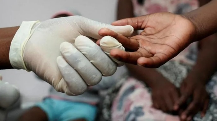 South Africans fear spike in HIV infections as US aid cuts bite ...